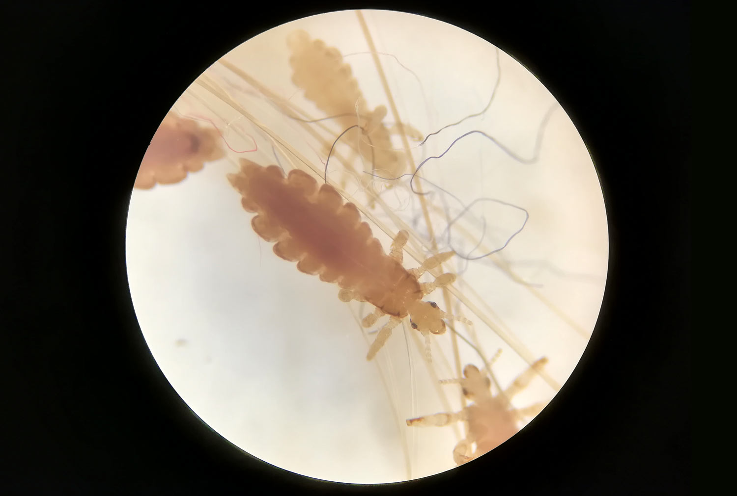 Sobre la pediculosis capitis – El desinsectador y desratizador